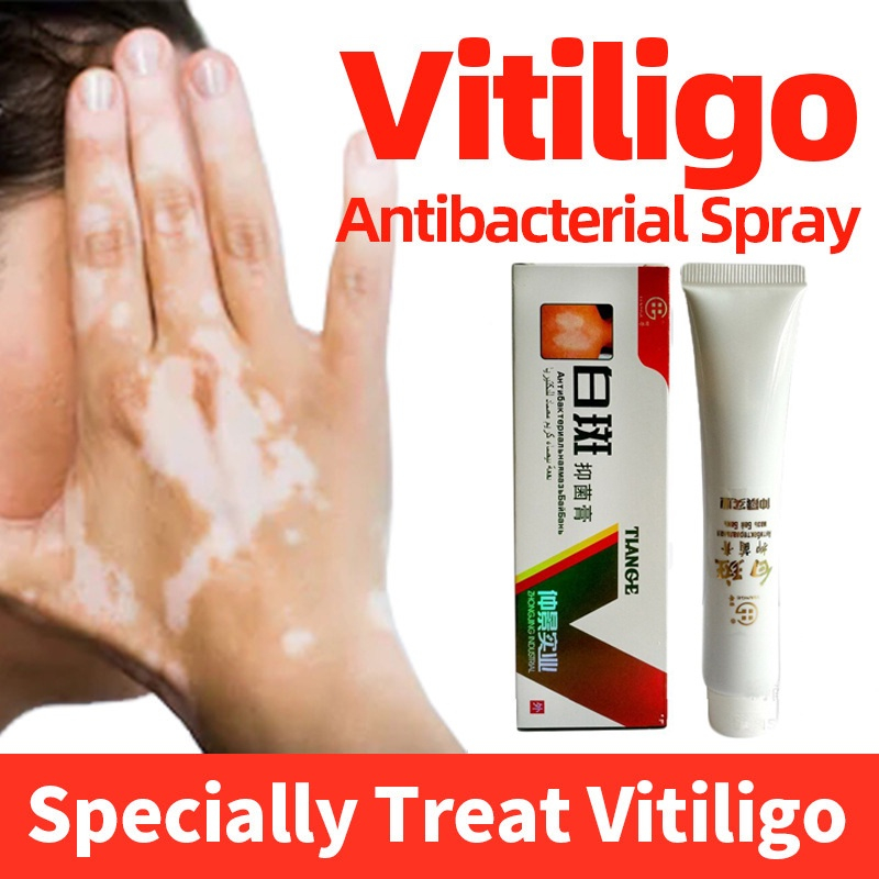 Jual TIANGE Salep Herbal 30g Original - Cream Untuk Kulit Belang Bercak ...