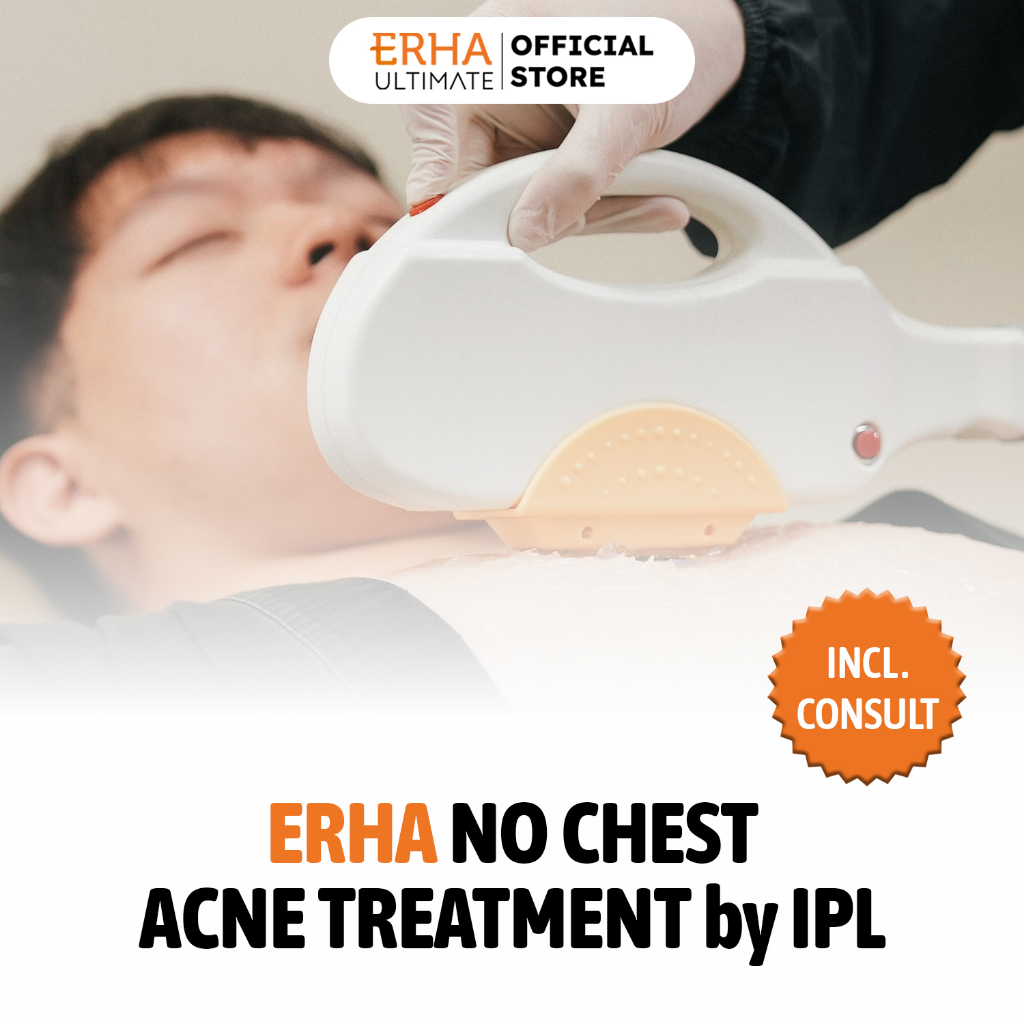 Jual ERHA No Chest Acne Treatment by IPL | Shopee Indonesia