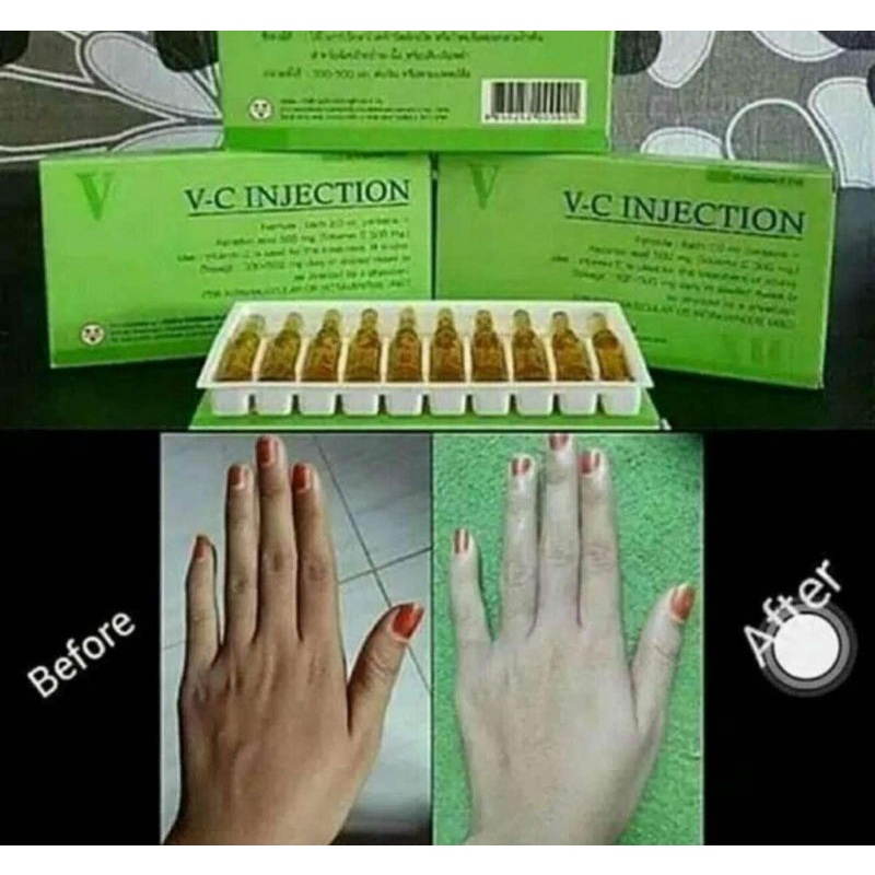 Jual vitamin c injeksi ori | Shopee Indonesia