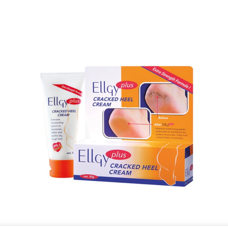 Jual ellgy cream 50gr, cracked heel cream, tumit pecah/kering | Shopee ...