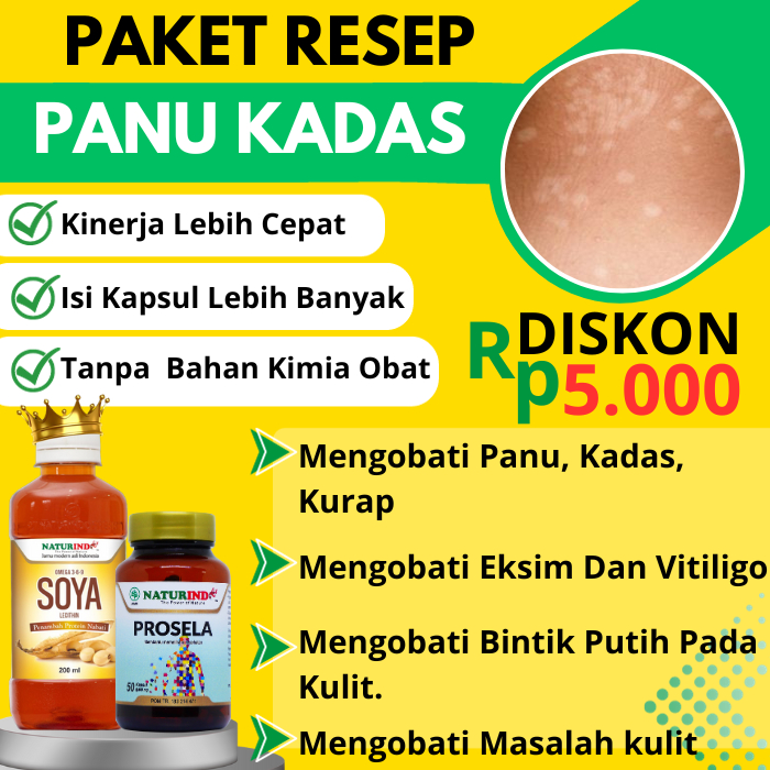 Jual Obat Panu Gatal Panu Kudis Kurap Obat Penghilang Panu Seluruh ...