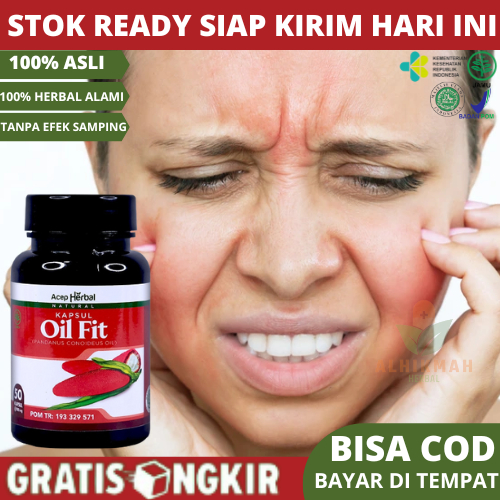 Jual Obat Penyakit Lupus Bercak Merah Di Kulit Wajah Peradangan Pada ...