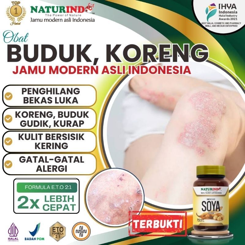 Jual Obat Budug koreng Obat Budug Di Kaki, Obat Budug Santri, Obat ...