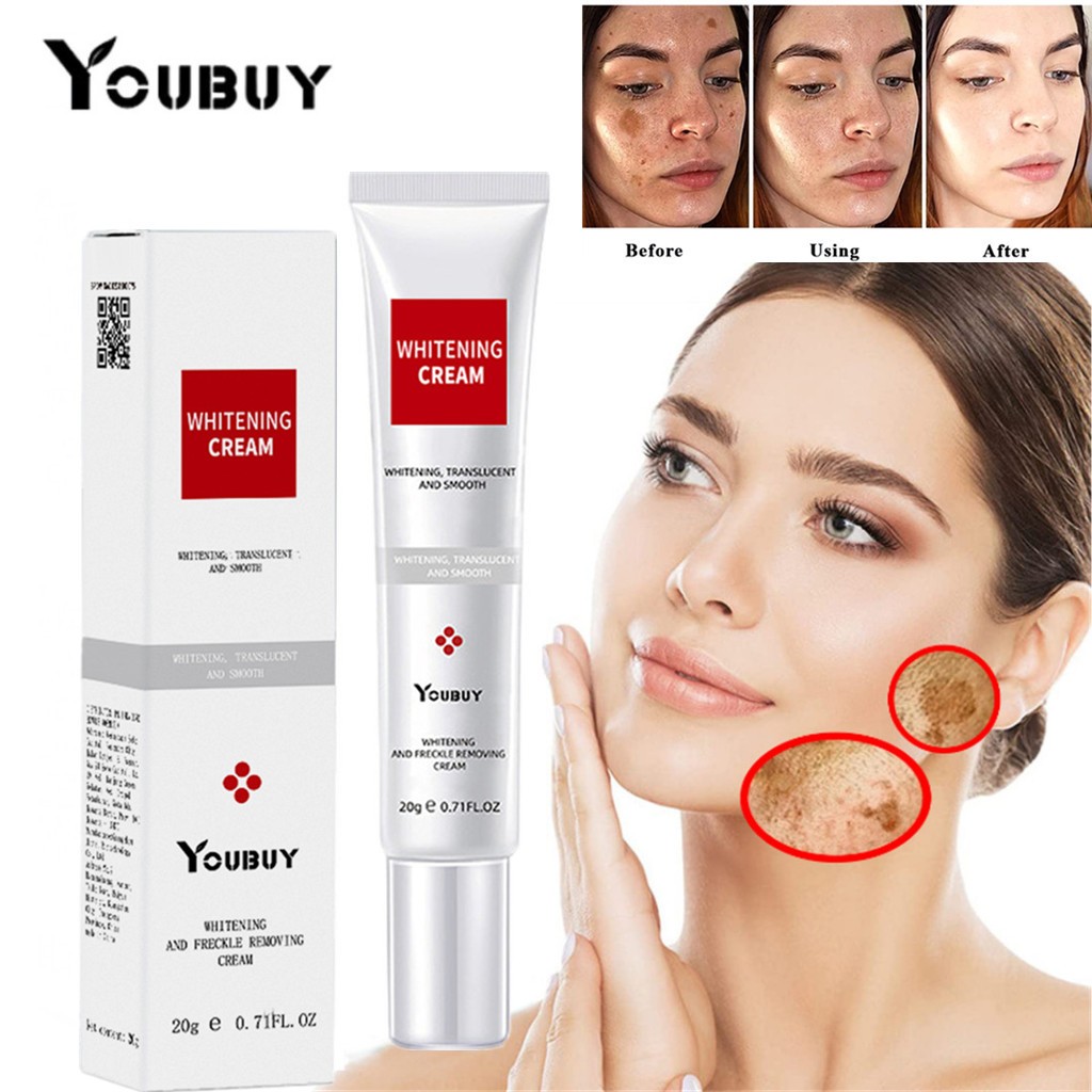 Jual 【BPOM】YOUBUY Whitening Freckle Cream Remove Dark Spots Anti ...