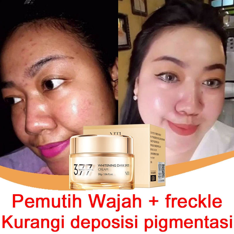 Jual whitening freckle cream salep flek hitam membandel cream pemutih wajah glowing cepat krim ...