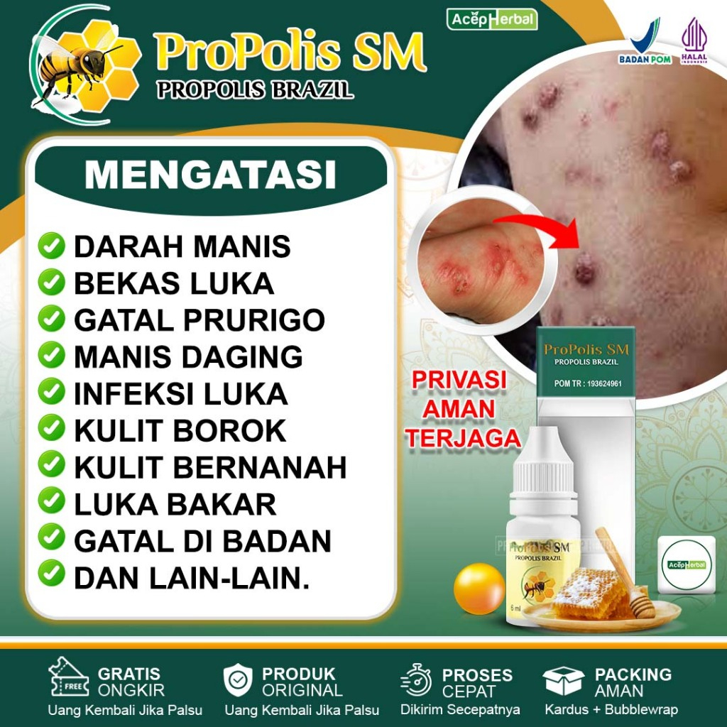 Jual Obat Darah Manis Dan Bekas Luka Gatal Prurigo Manis Daging Infeksi ...