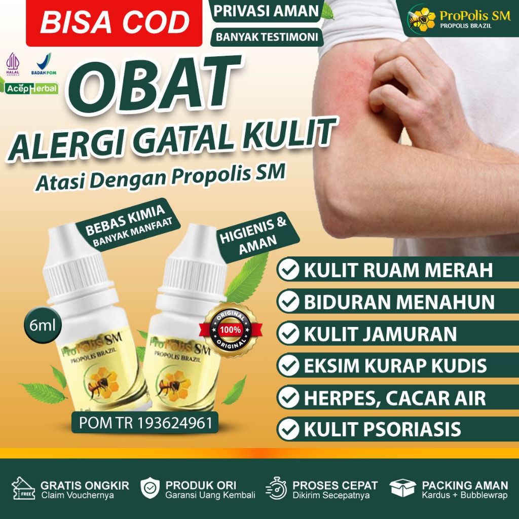 Jual Obat Alergi Gatal Kulit Biduran Ruam Merah Luka Gatal Eksim Jamur ...