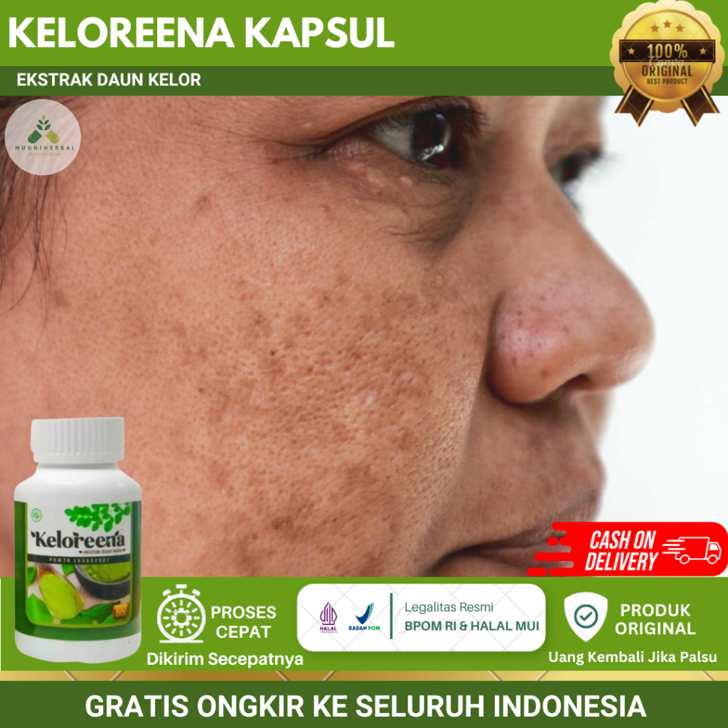 Jual Keloreena Kapsul 100% Original - Obat Untuk Flek Hitam, Noda Hitam ...