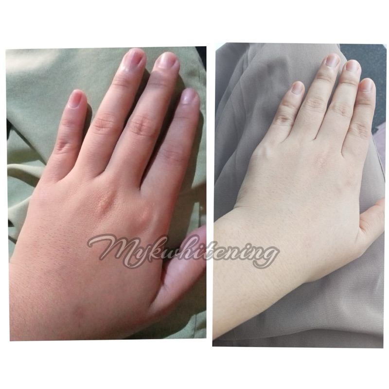 Jual Multivitamin Infus Whitening by Mykwhitening | Shopee Indonesia