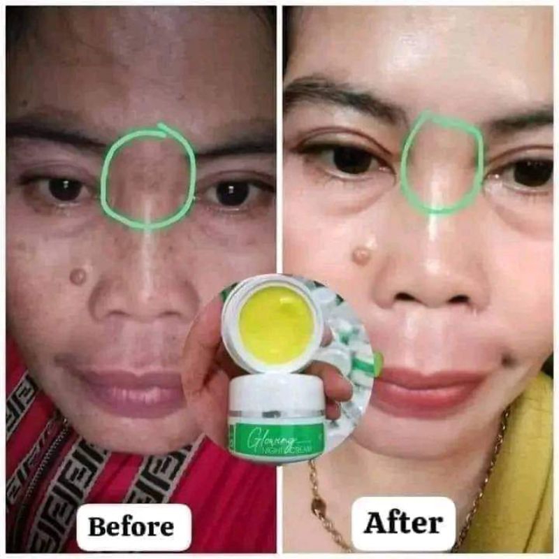 Jual salap maxieskincare | Shopee Indonesia