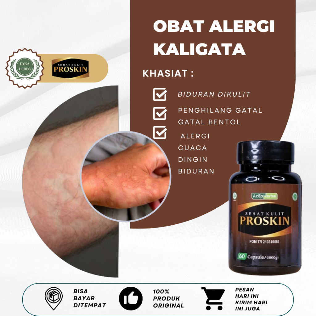 Jual KAPSUL PROSKIN Alergi Gatal Biduran Alergi Dingin Gatal Biduran ...
