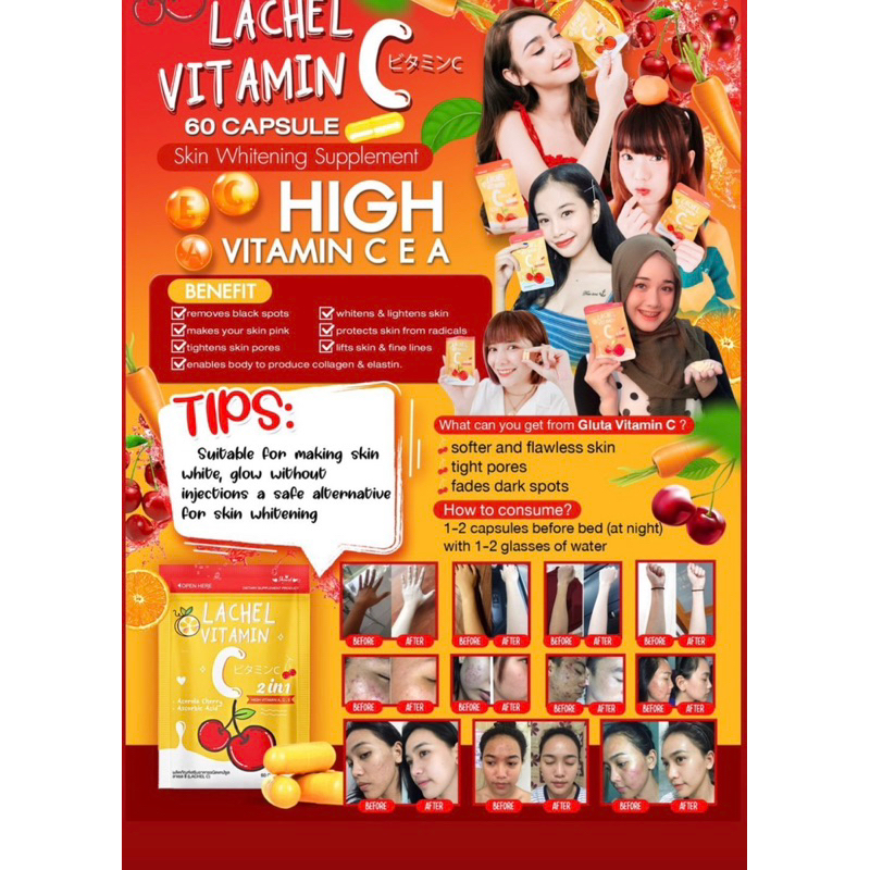 Jual LACHEL VITAMINE C | Shopee Indonesia