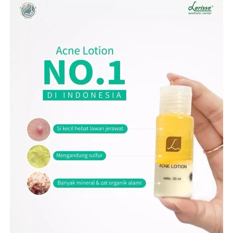Jual Acne Lotion Larissa | Shopee Indonesia