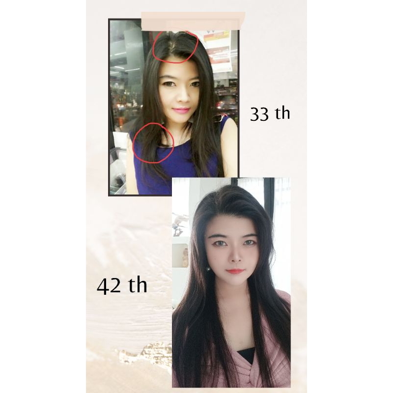 Jual shampoo ginger dan hair tonic ginseng | Shopee Indonesia