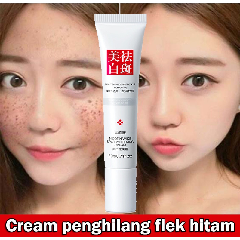Jual NEW CINDYNAL Dark Spots Flek Hitam Krim Perawatan Kulit Pemutih Efektif Pigmentasi ...