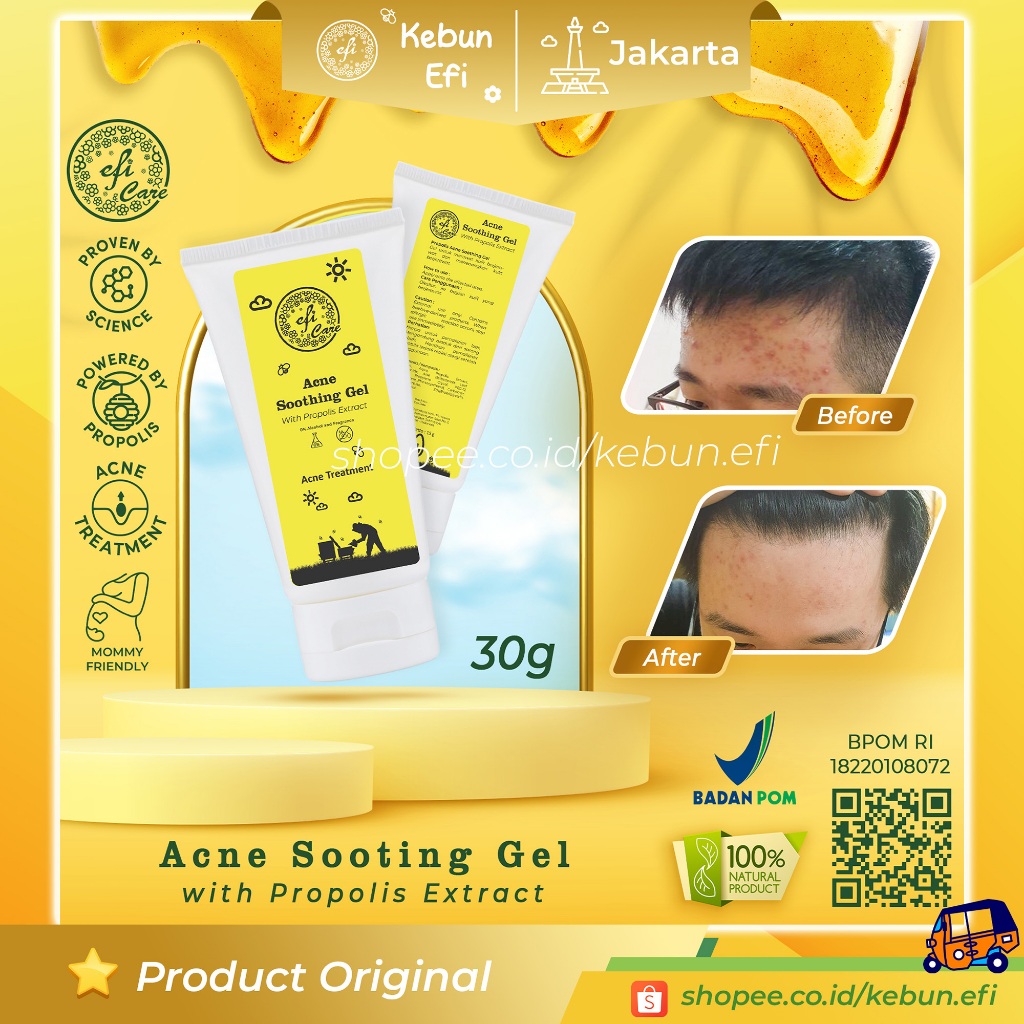 Jual Propolis Acne Natural Treartment by Prof Felix - Kebun Efi ...