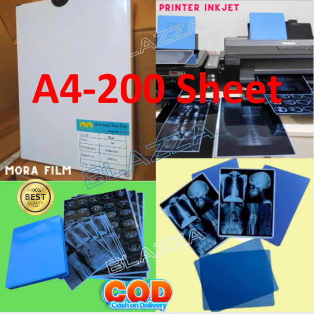 Jual Medical Dry Film Radiology Digital Rontgen X-Ray | Blue Base ...