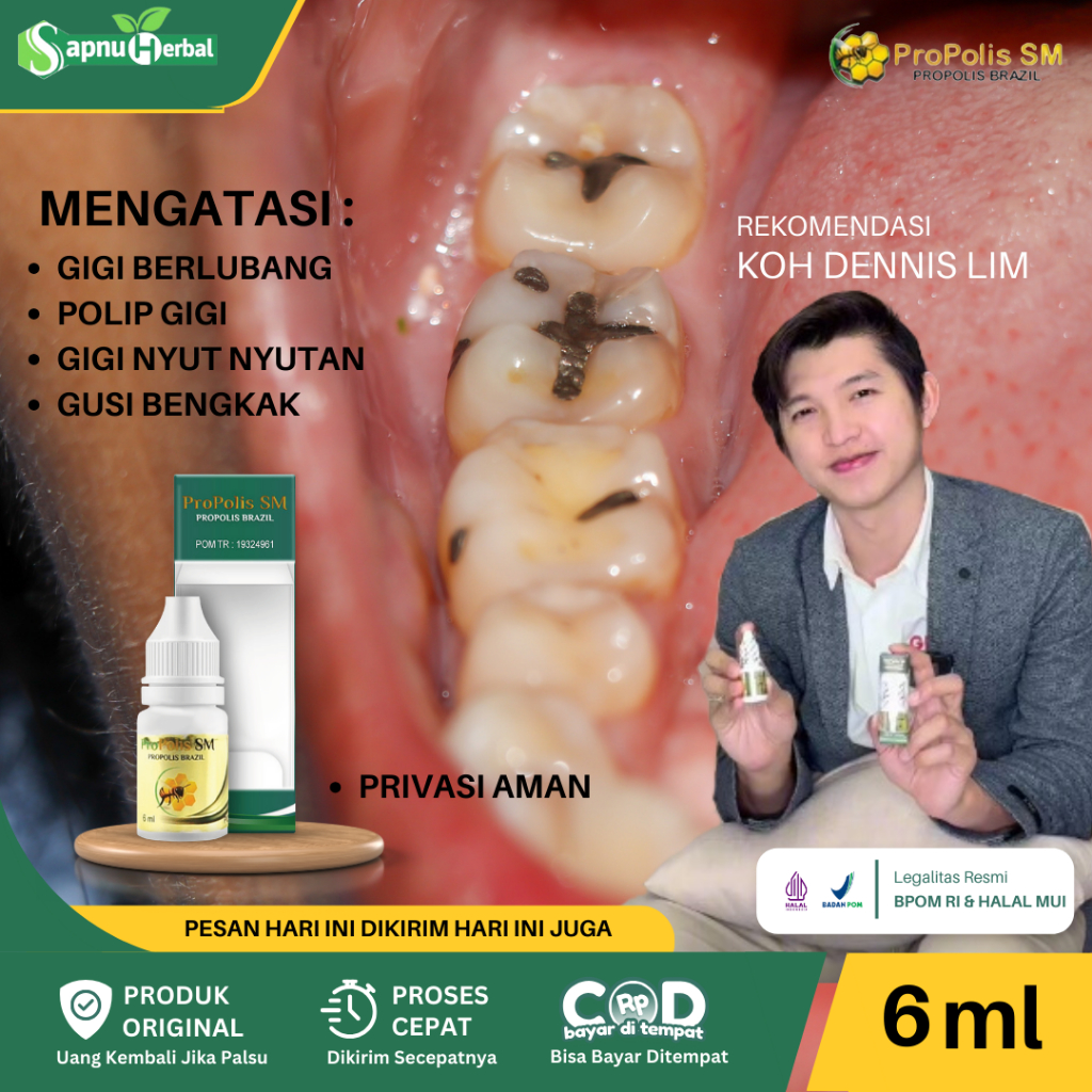 Jual Obat Sakit Gigi Berlubang, Gusi Bengkak, Gigi Berlubang, Agar Gigi ...
