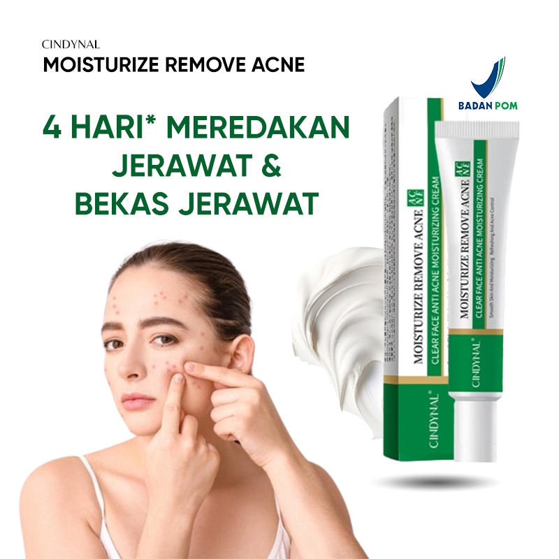 Jual BPOM CINDYNAL Krim Obat Jerawat dan Bekas Jerawat Paling Ampuh - Cream Moisturize Acne ...