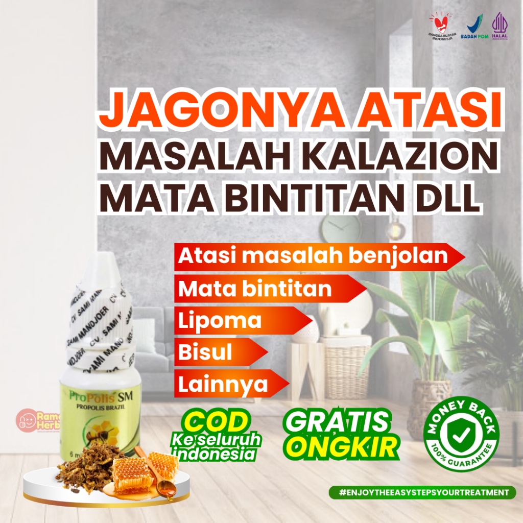 Jual [BISA COD] Obat Kalazion Di Apotik / Mata Bintitan / Benjolan Di ...
