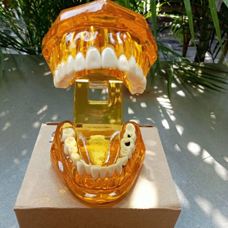Jual dental study model gigi transparan phantom gigi removable | Shopee ...