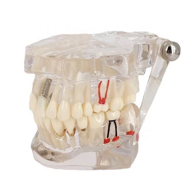 Jual Dental Study Model Gigi Transparant Phantom// Gigi Removable ...