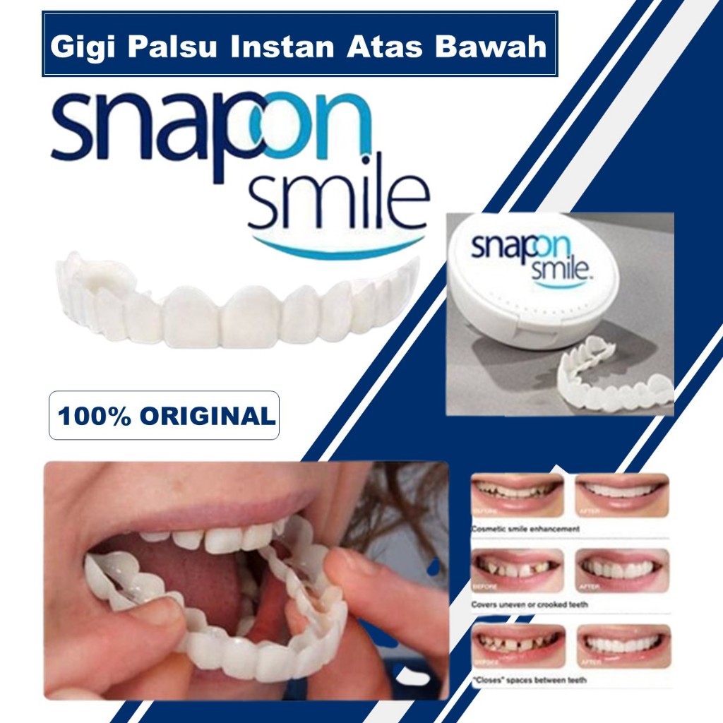 Jual Snap On Smile Gigi Palsu 1 Set Atas Bawah - Gigi Palsu Silikon ...