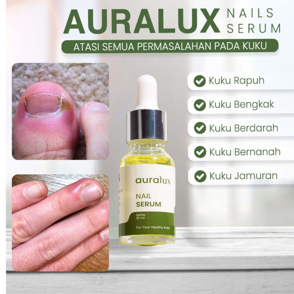 Jual Auralux Nail Serum - Obat Cantengan Kuku Kaki dan Jamur Kuku Kaki ...