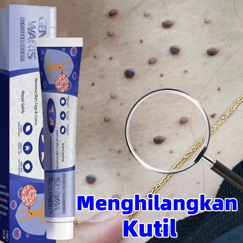 Jual Obat Kutil Penghilang Kutil Penghilang Tahi Lalat Di Leher ...