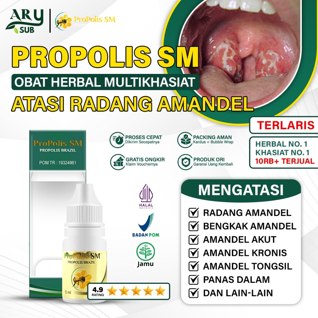 Jual Obat Radang Amandel Sakit Tenggorokan Leher Gatal Sakit Sulit Untuk Menelan Panas Dalam ...
