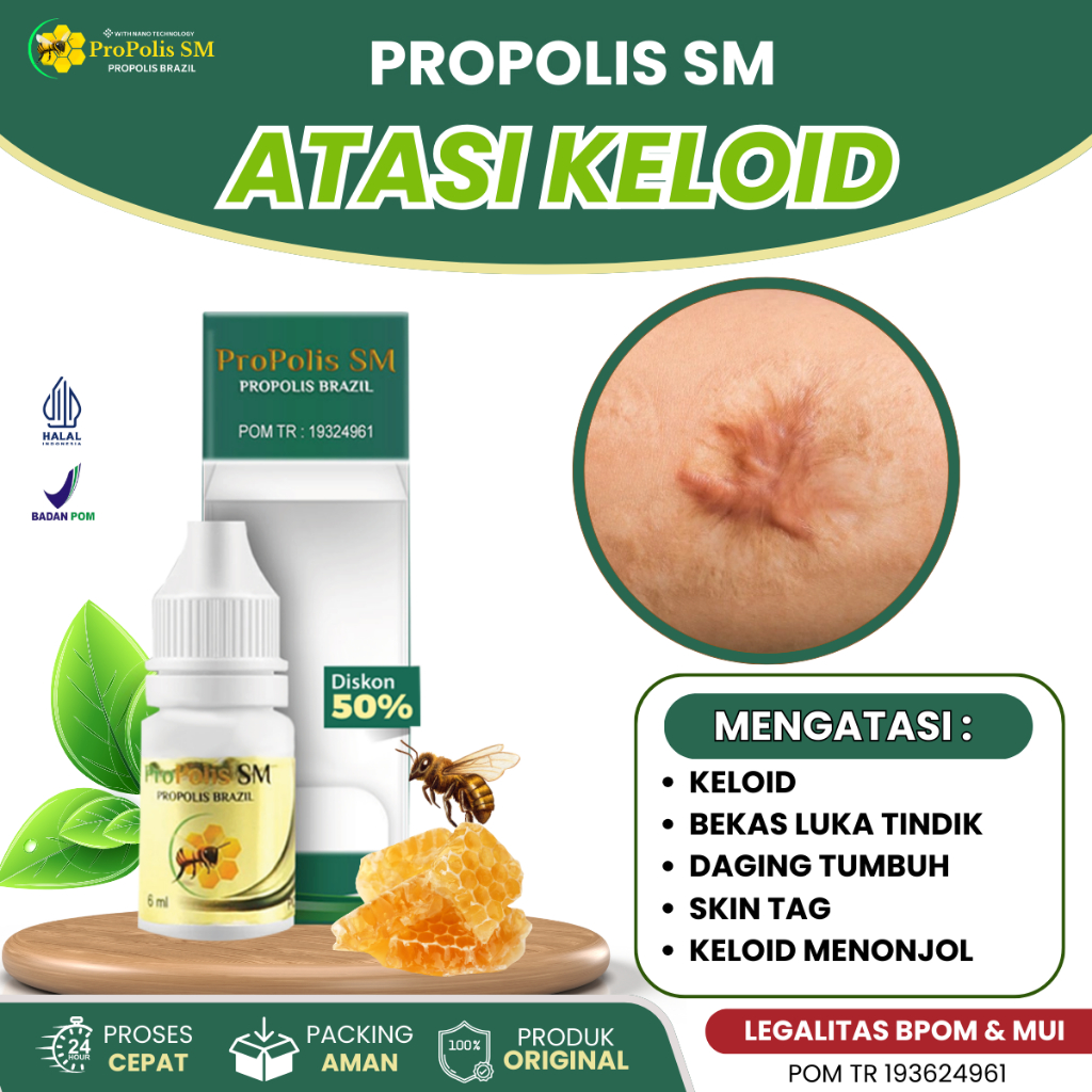 Jual Obat Keloid, Obat Daging Tumbuh, Obat Keloid Di Telinga, Obat ...