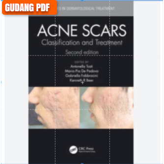 Jual Pdf Acne scars classification and treatment | Shopee Indonesia