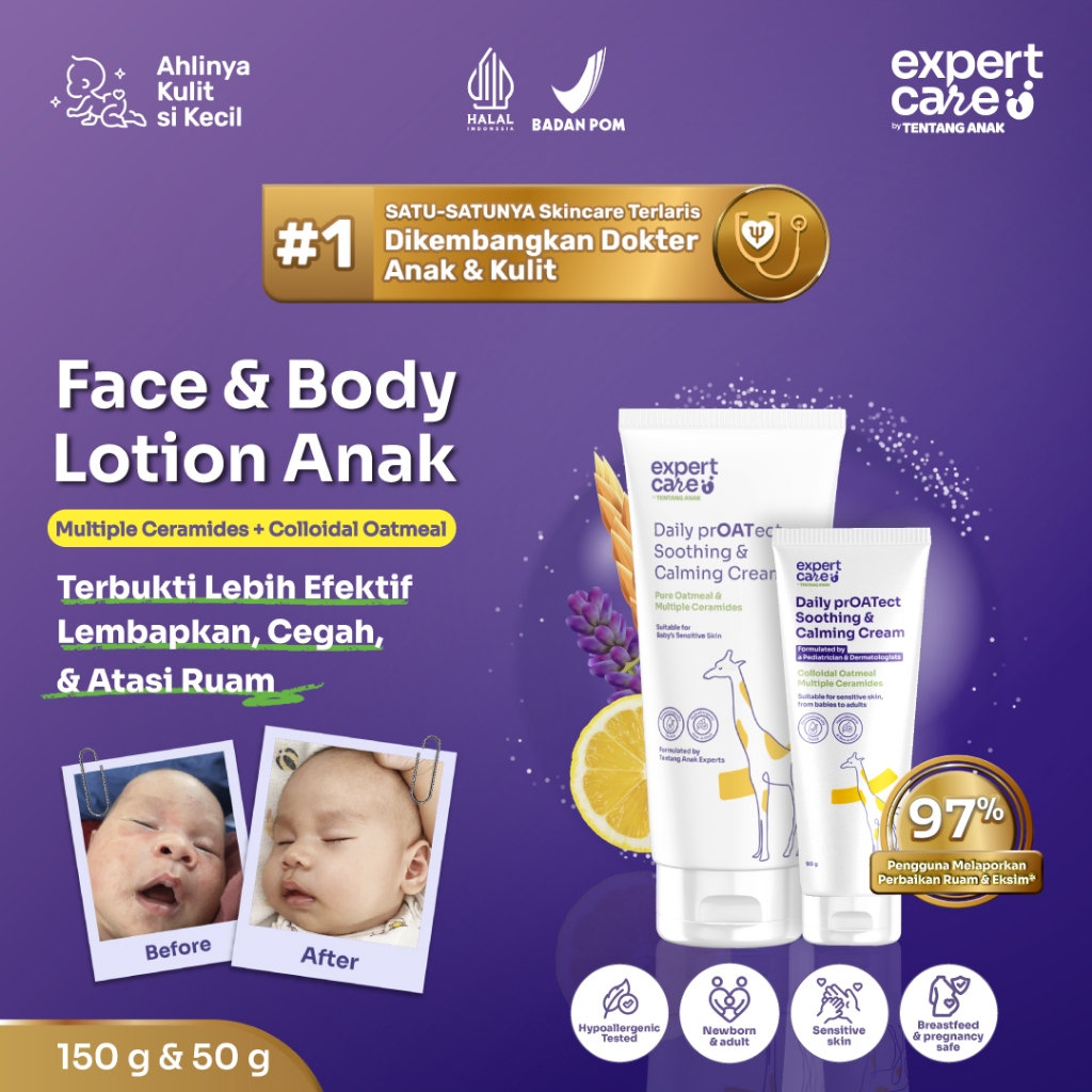 Jual Expert Care Face & Body Lotion Cream Moisturizer | Pelembap Bayi ...
