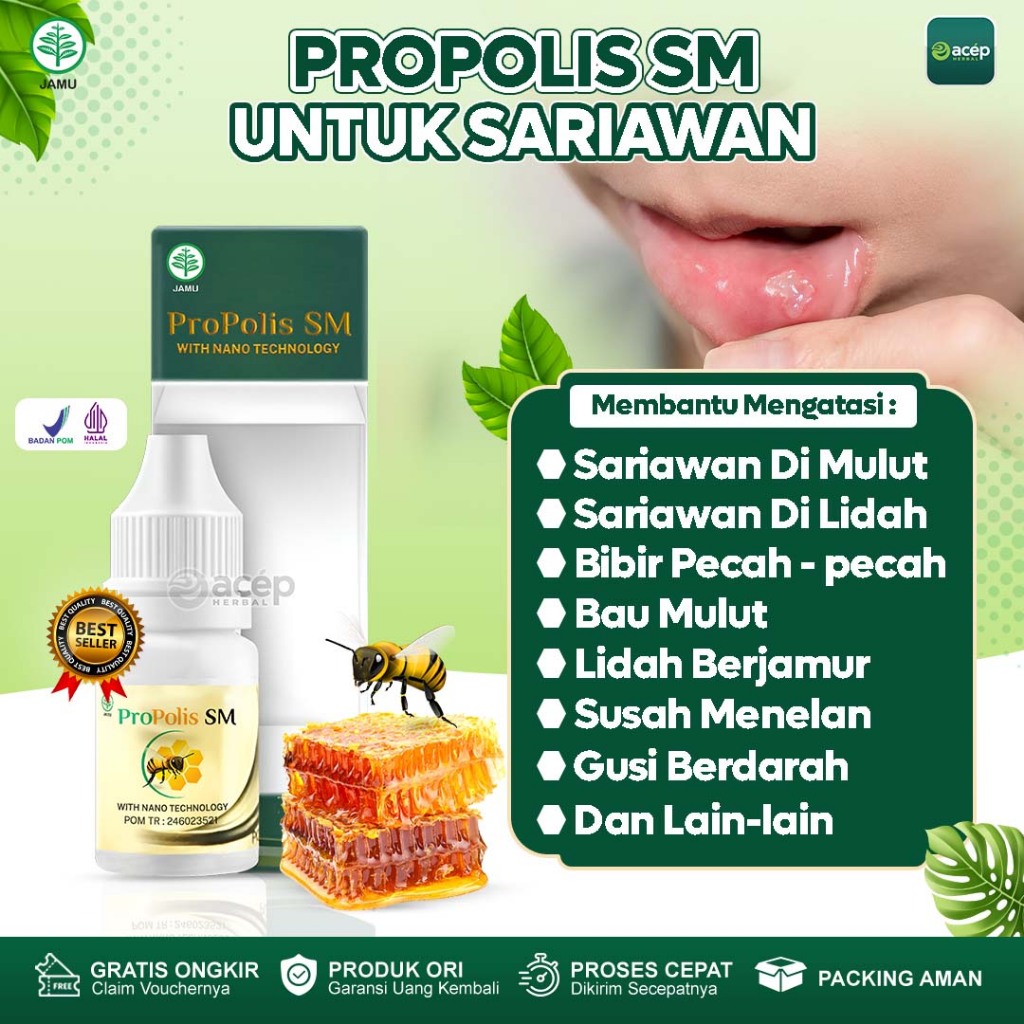 Jual Obat Sariawan Di Bibir Mulut Dan Lidah Panas Dalam Atasi Bau Mulut ...