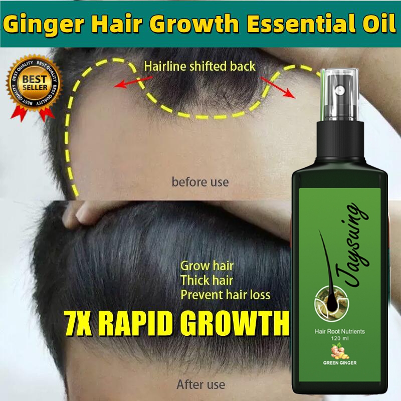 Jual serum penumbuh rambut hair growth spray Obat penumbuh rambut ...