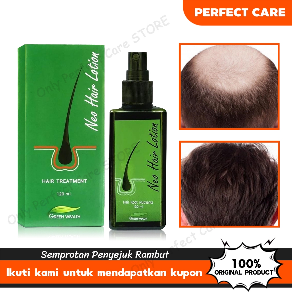 Jual OUHOE Hair Root Nutrients Spray 120ml Semprotan Penumbuh Rambut ...