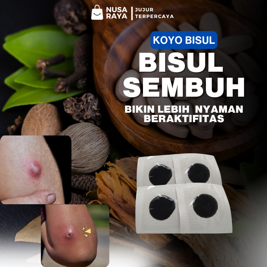 Jual Obat Bisul - Plester Bisul Koyo Penghilang Bisulan Udunan Paling Ampuh | Shopee Indonesia