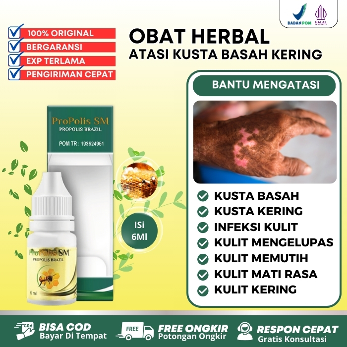 Jual Obat Kusta Basah Kering lepra infeksi bakteri kronis menular Kulit ...