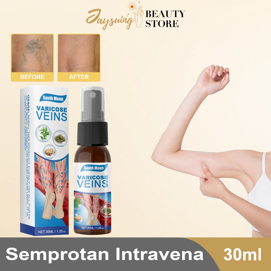 Jual Maikang Cream Varicose Veins obat varises di kaki dan betis paling ...