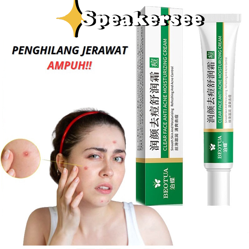 Jual Cindynal X BEOTUA Salep Obat Paling Ampuh Mengatasi Jerawat ...