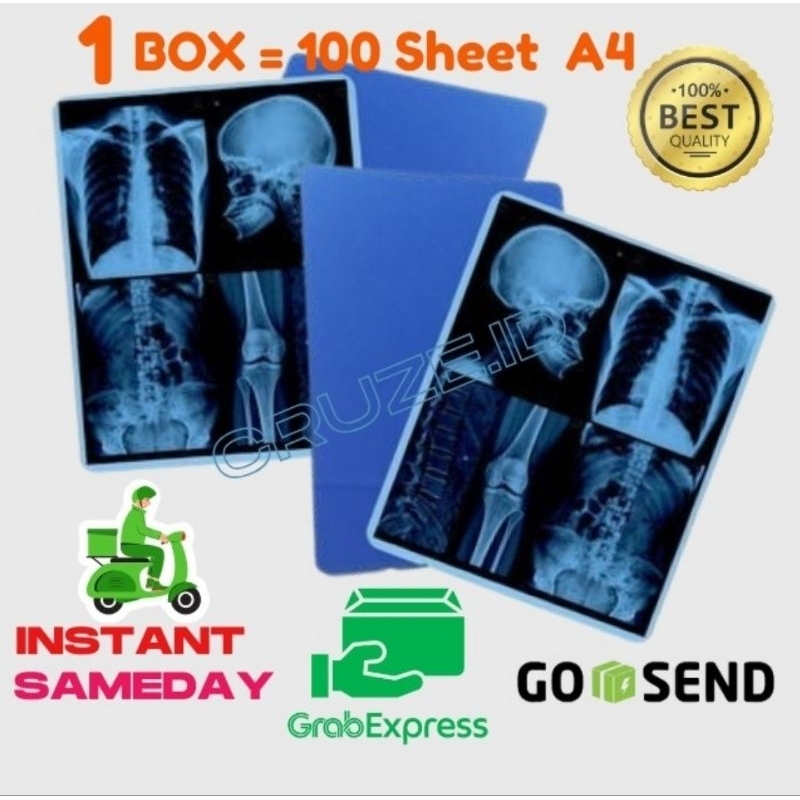 Jual Medical Dry Film Digital Radiology DR CR Rontgen X-Ray Inkjet ...