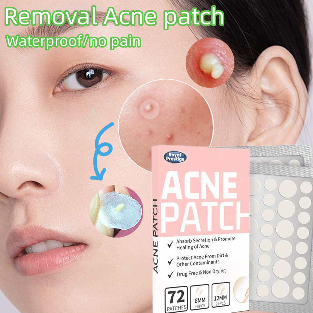 Jual Acne Pimple Patch Penghilang Jerawa Sticker Jerawat Penghilang ...
