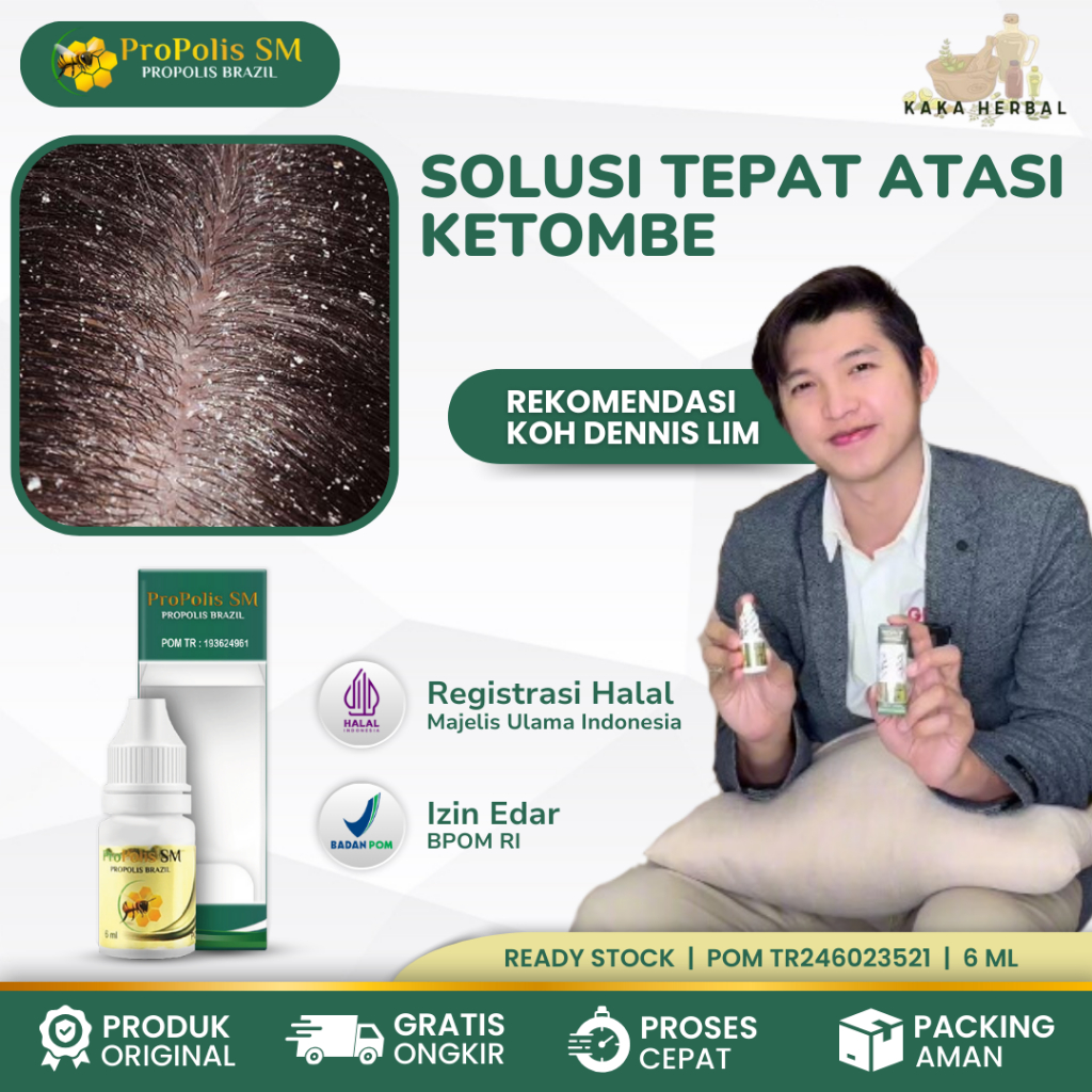 Jual Kaka Herbal - Obat Ketombe, Obat Ketombe Berkerak, Obat Ketombe Rambut, Penghilang Ketombe ...