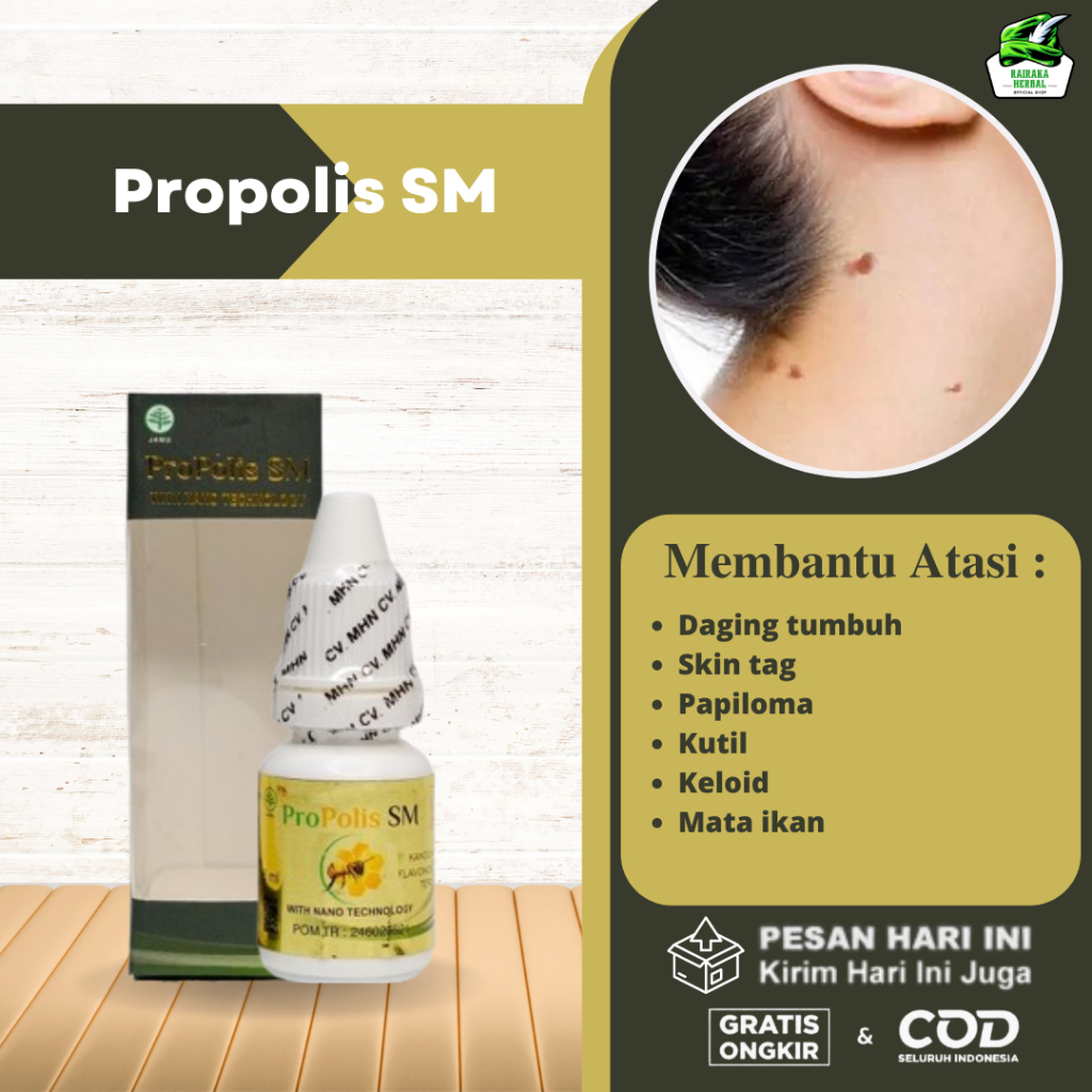 Jual Obat Pengempis Daging Tumbuh, Obat Skin Tag, Obat Penghilang ...