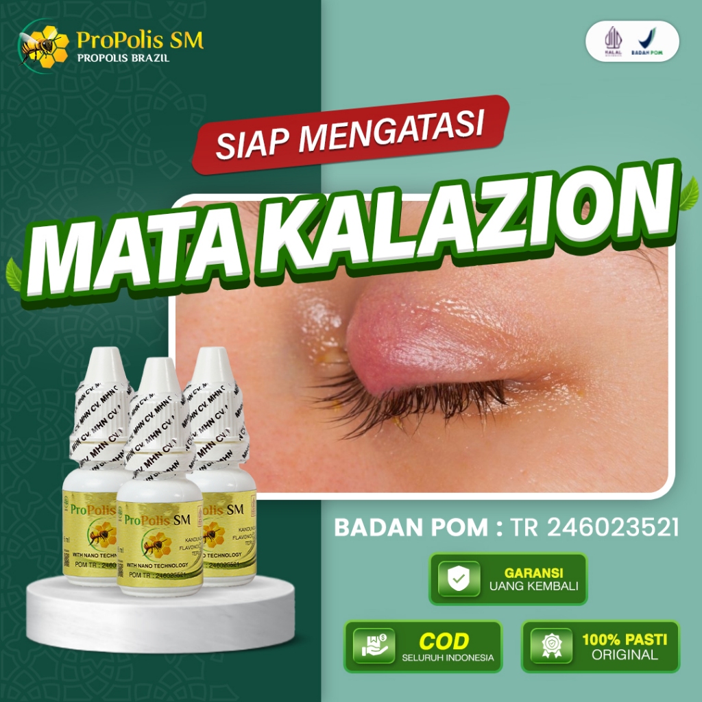 Jual Obat Mata Kalazion Benjolan Bengkak Di Mata Bisul Bintilan ...