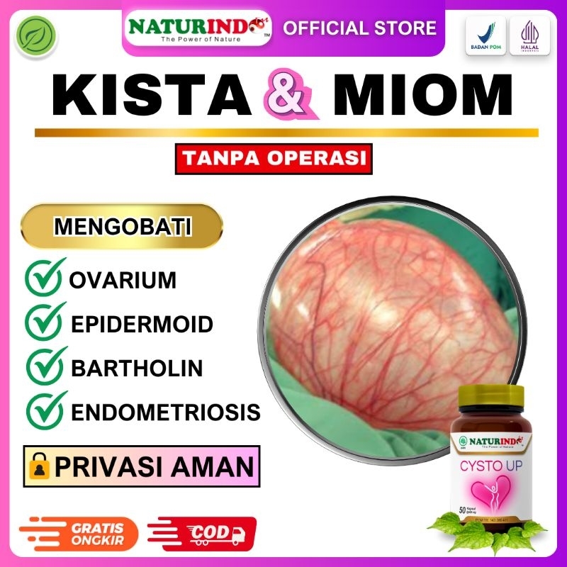 Jual Obat Miom Myom Kista Ovarium Bartholin Kista Coklat Kista Tiroid ...