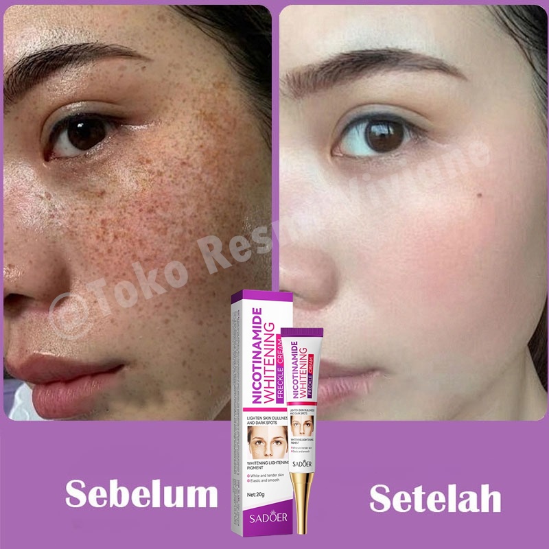 Jual cream flek hitam membandel krim penghilang flek hitam krim pemutih ...