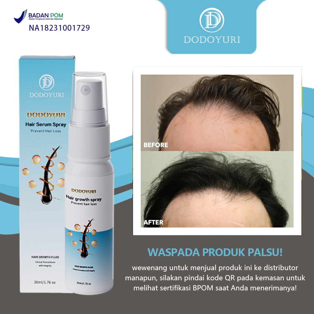 Jual [BPOM] DODOYURI Penumbuh rambut botak Serum penumbuh rambut Obat ...