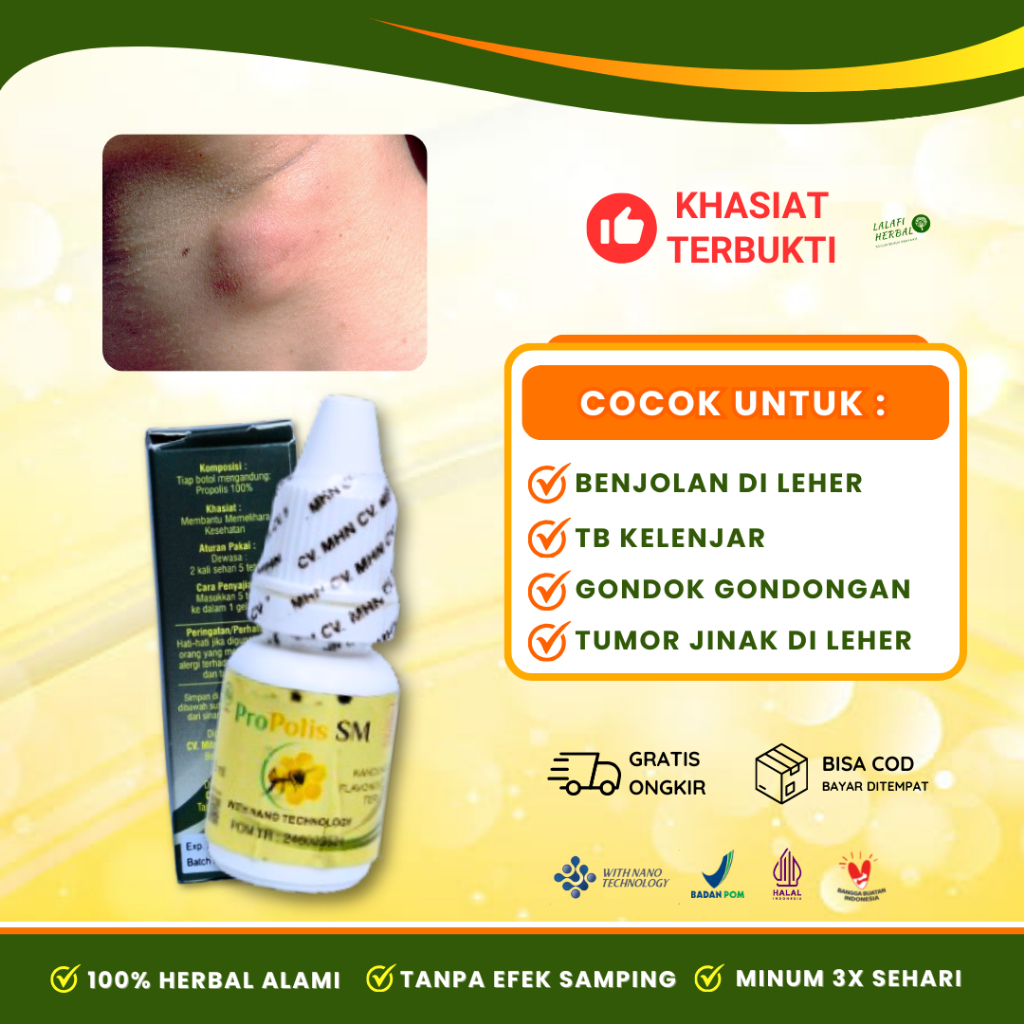 Jual Obat Benjolan Gondok Tiroid di Leher TB Kelenjar Teroid | Shopee ...