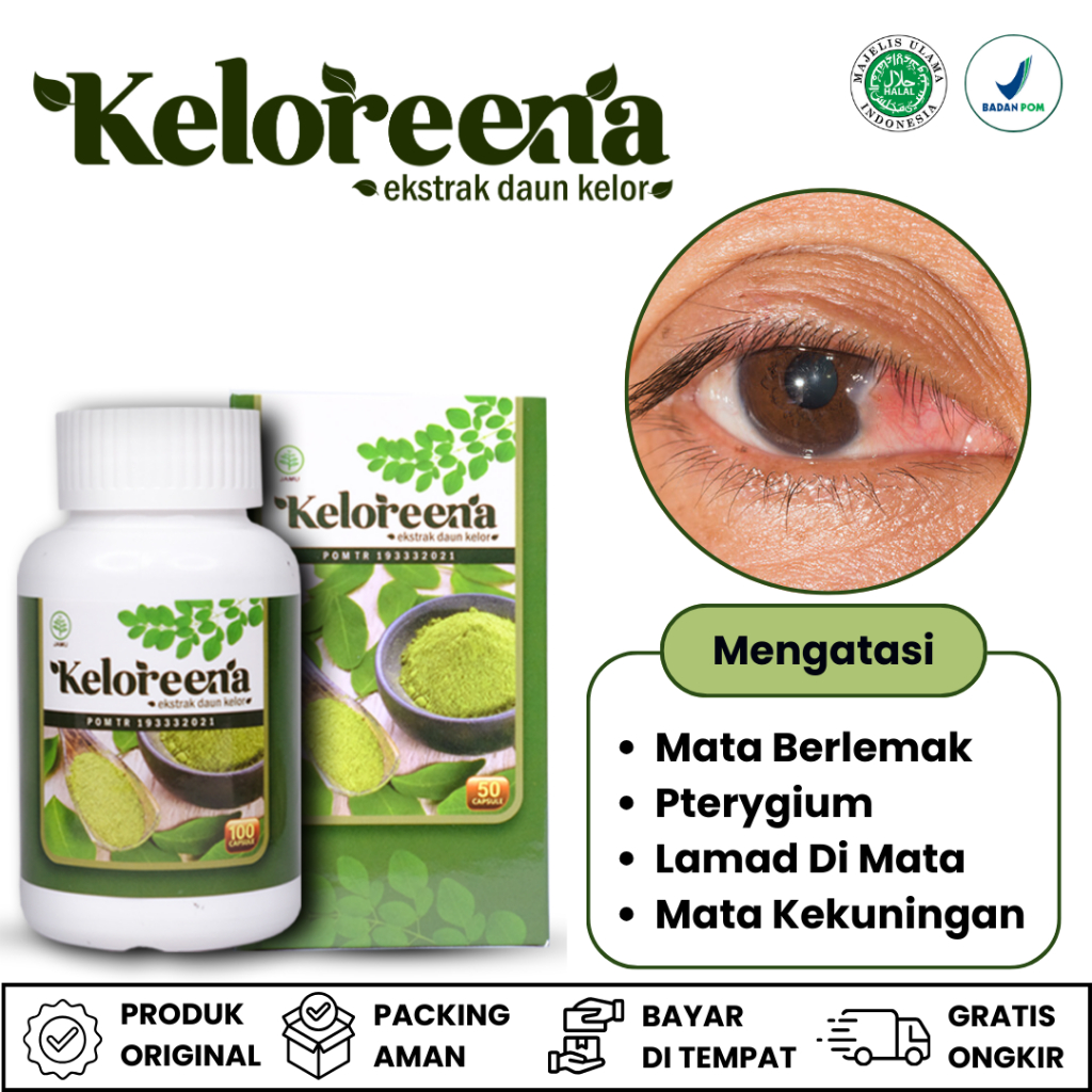 Jual Obat Mata Berlemak Pterygium Penghilang Lemak Di Mata Lamad Di Mata Kapsul Keloreena Asli ...
